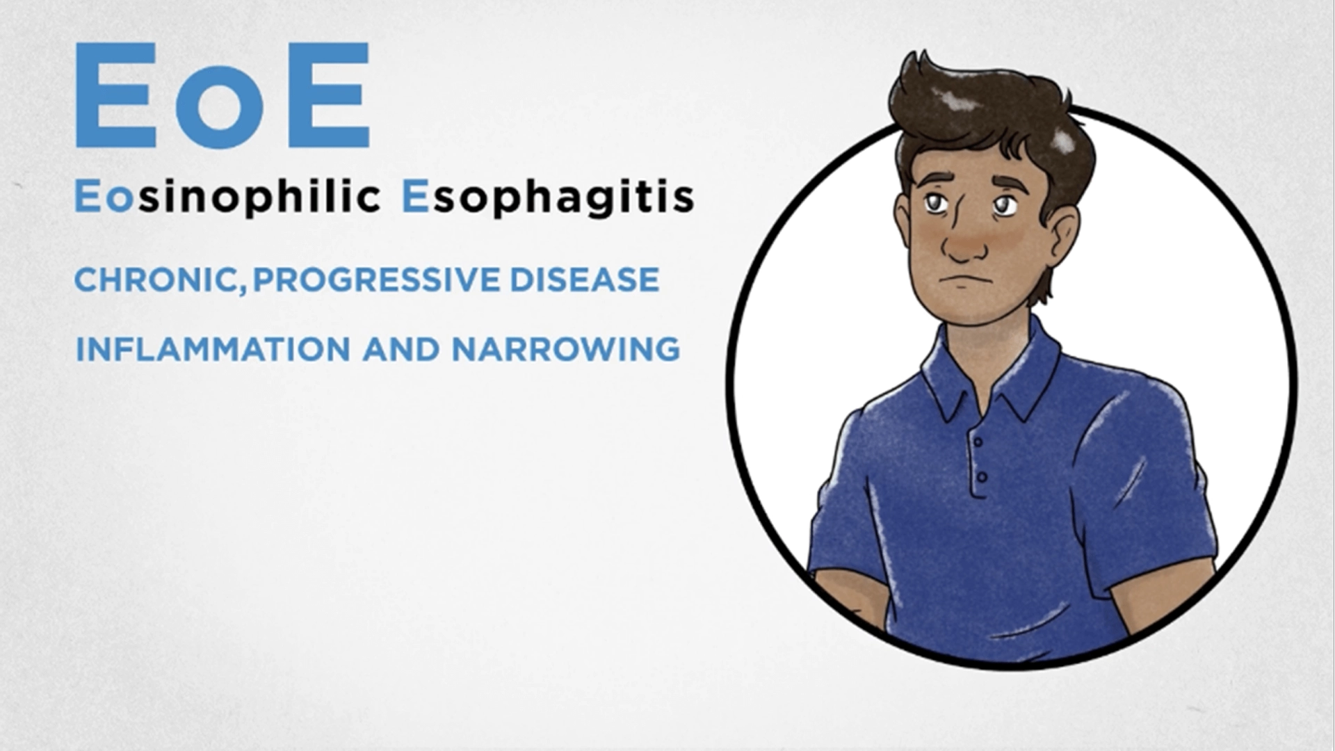 EoE Support & Resources | Understand EoE